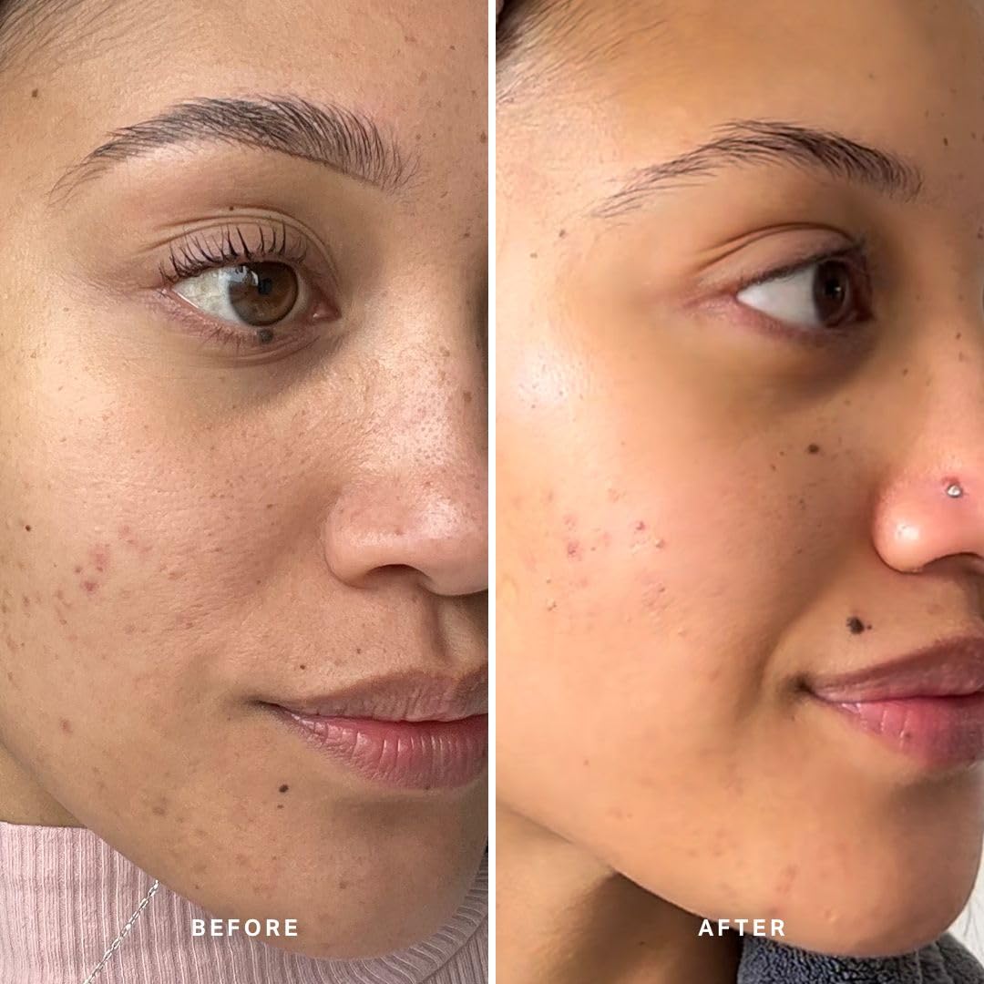 LIQUID GOLD EXFOLIATING TREATMENT WITH 5% GLYCOLIC ACID
