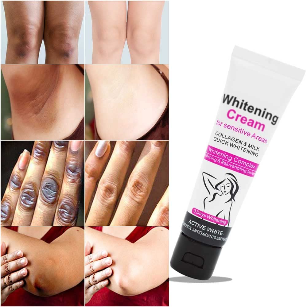 Acclyd Dark Spot Corrector Skin Lightening Cream for Body, Intimate Areas, Underarms, Armpit, Knees, Legs, Elbows and Inner Thigh, Whitening Cream Dark Spot Remover for Sensitive Areas (1.76 Fl Oz)