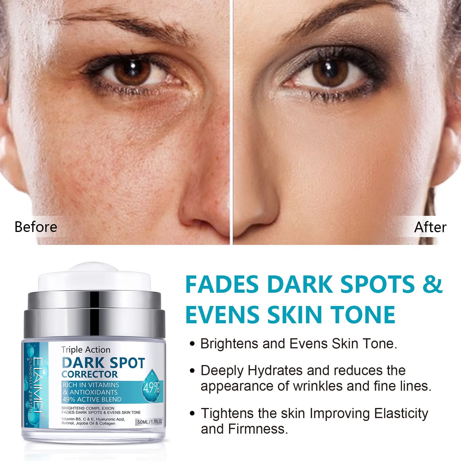 AIOBEECY Dark Spot Corrector Cream - Evens Skin Tone, Reduces Pigmentation & Sunspots, for Face & Body (5.65 oz)