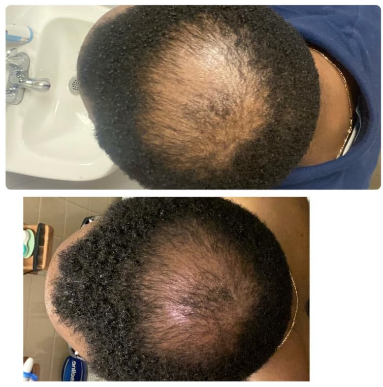 Kreyol Essence – 8 Oz DEEP CONDITIONER MASK, Scalp Care Reduce Shed + Repair Hair Mask, Overnight Moisture Mask