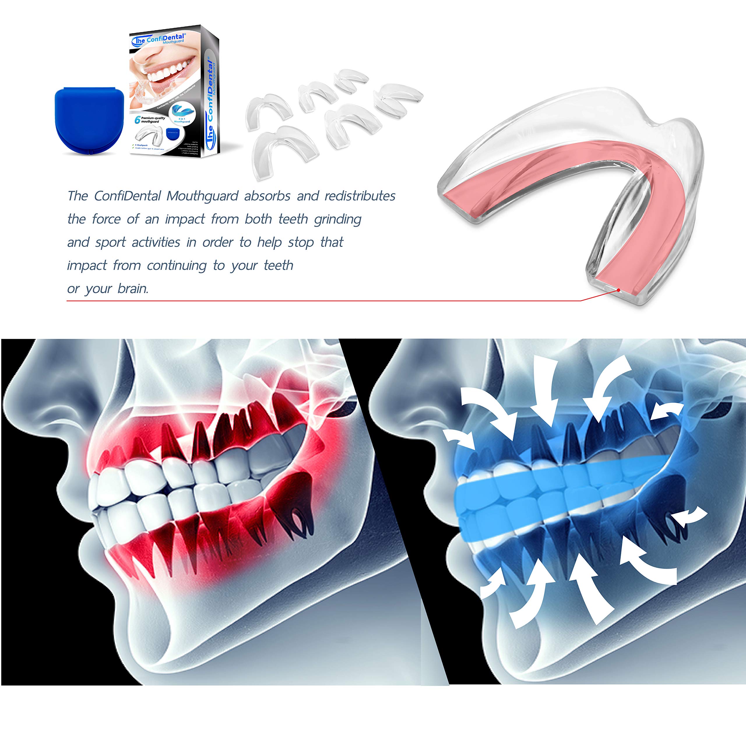 The ConfiDental - Pack of 6 Moldable Mouth Guard for Teeth Grinding Clenching Bruxism, Sport Athletic, Whitening Tray