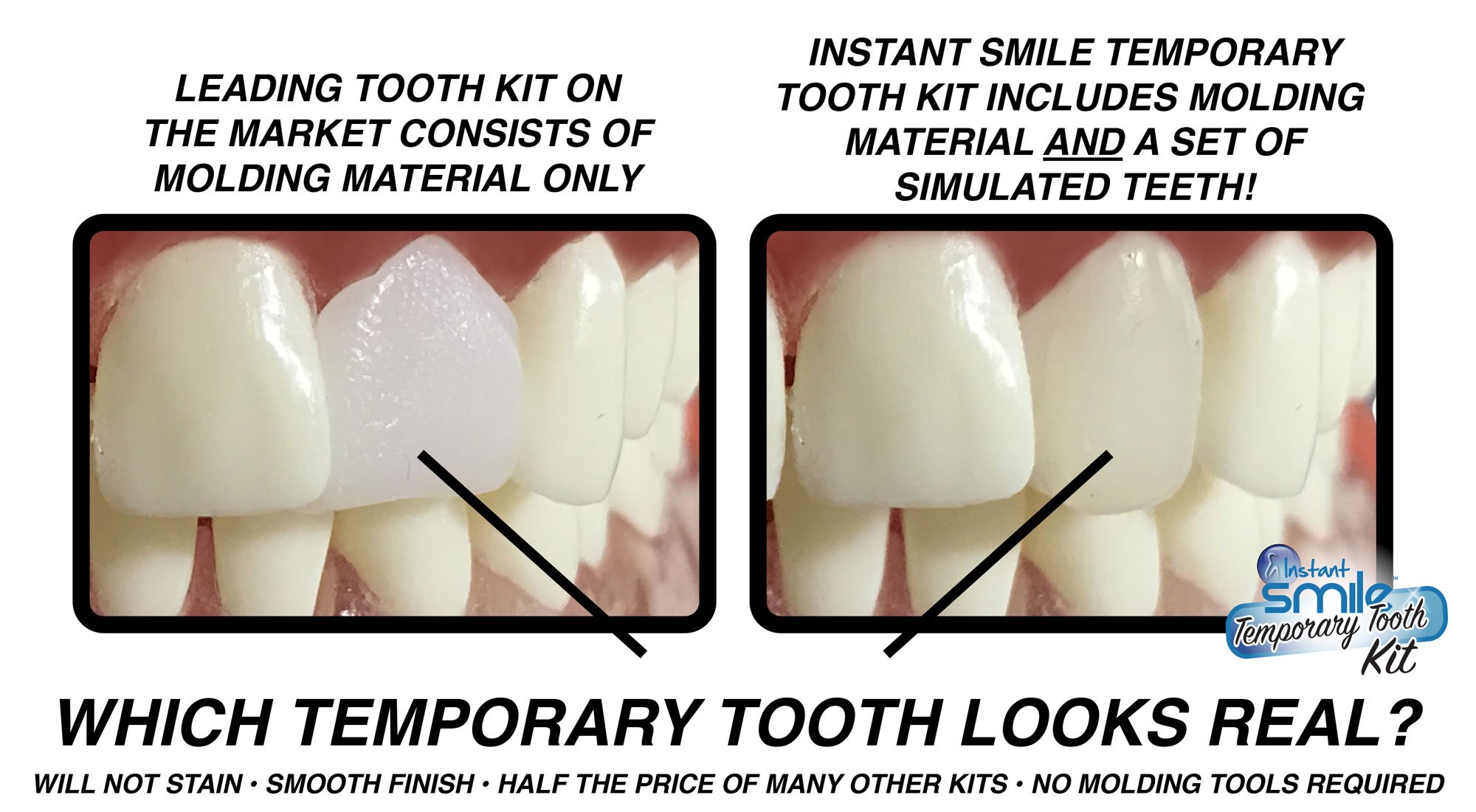 Instant Smile MULTISHADE Patented Temporary Tooth Repair Kit. A Realistic Looking Fix for a Missing or Broken Tooth.