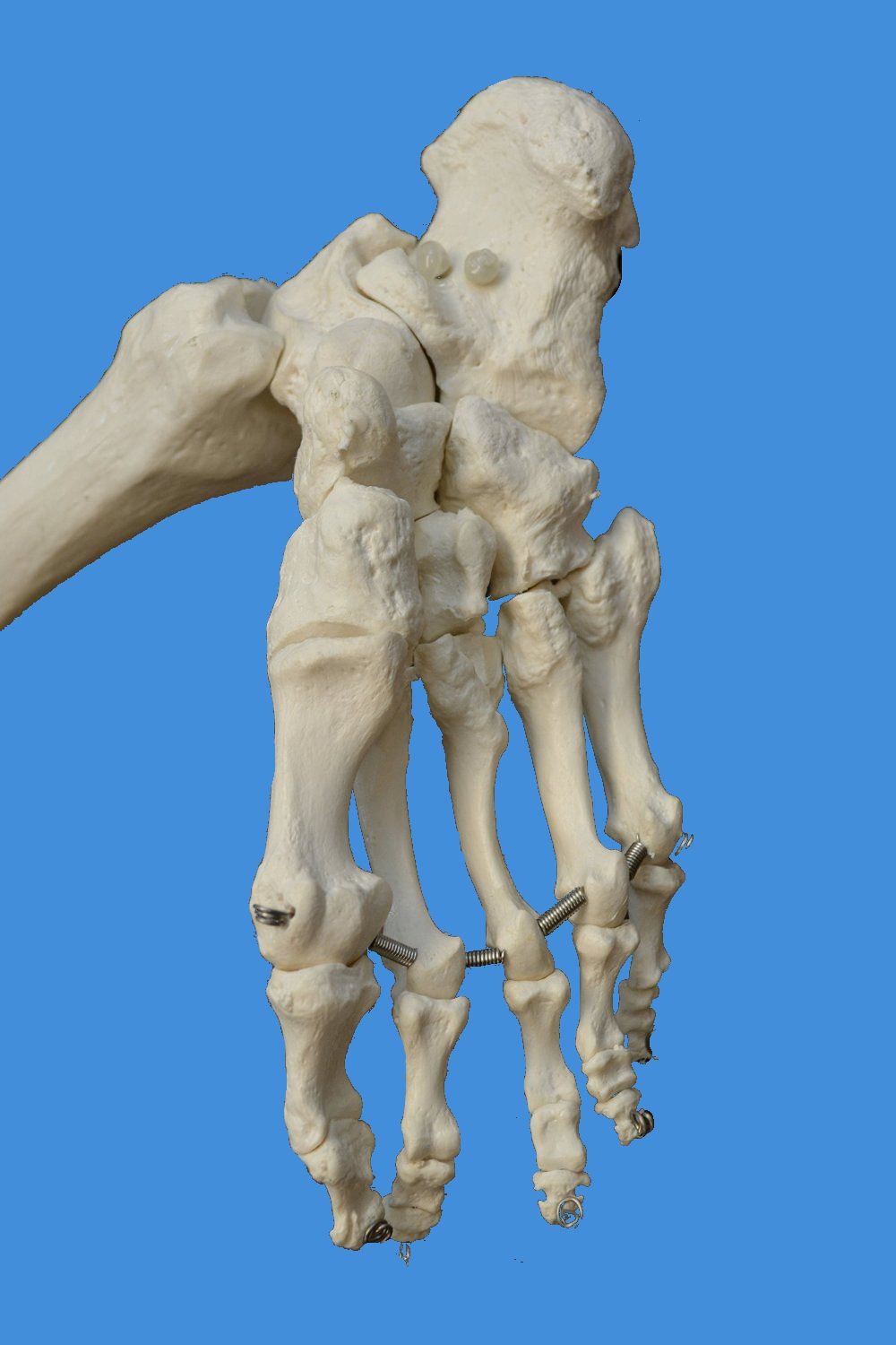 Wellden Medical Anatomical Human Lower Limb Skeleton Model, Life Size