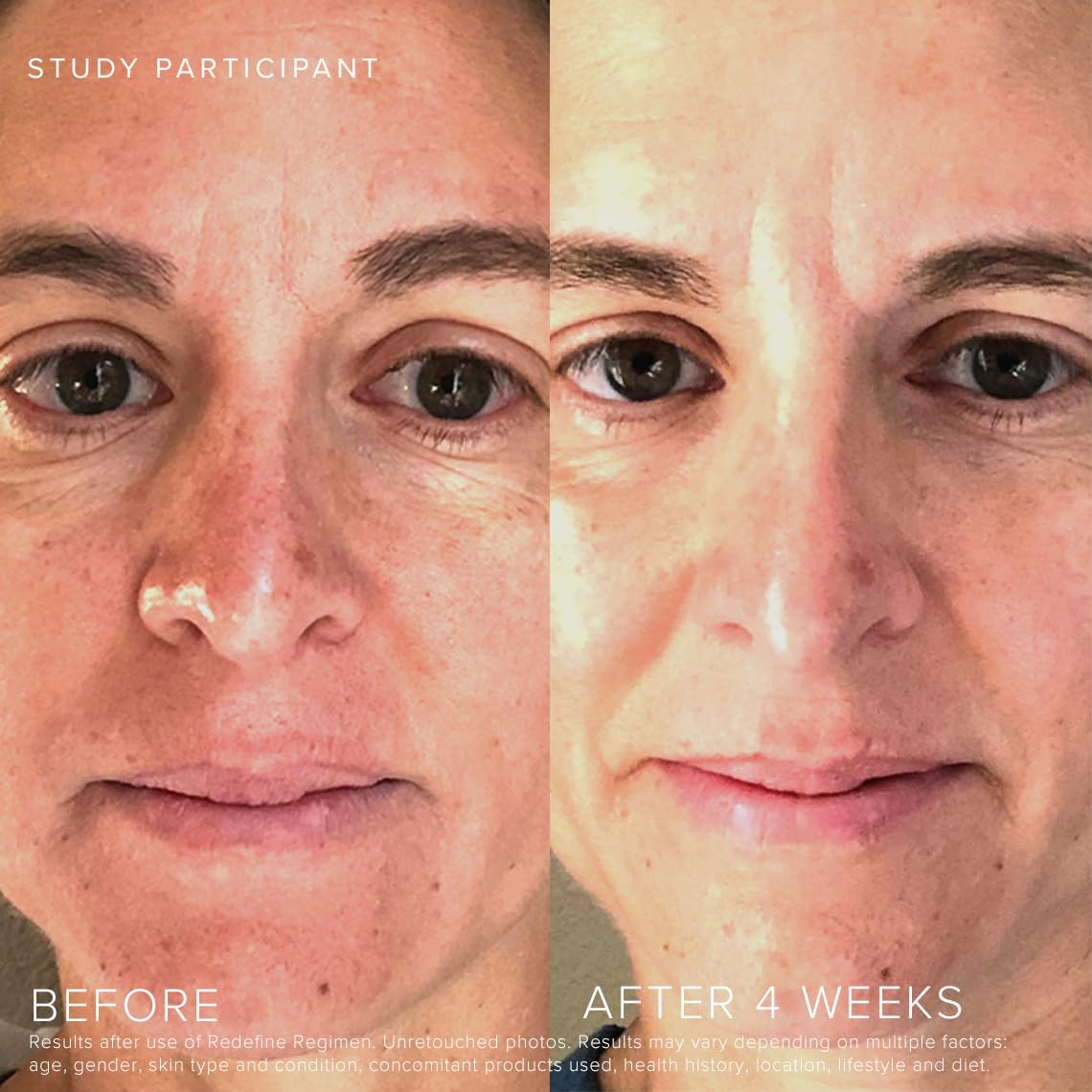 Rodan + Fields Redefine Regimen | Skincare Kit Includes Clay Cleanser, Toner, Triple Defense Cream, & Overnight Cream | Skin Care Gift Set for Women