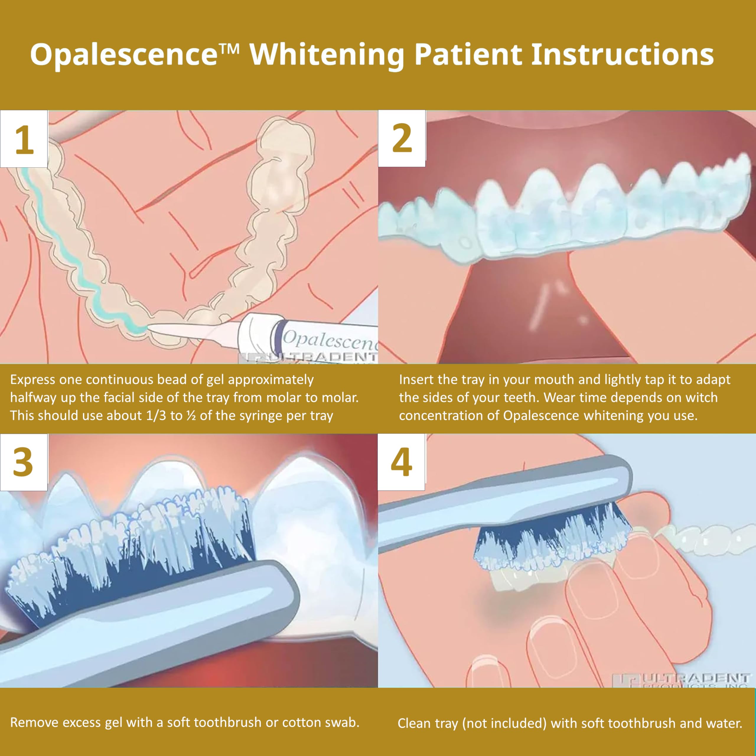 Opalescence 45% Syringes Teeth Whitening Gel - with PF - (4 Syringes) Refill Kit Carbamide Peroxide. Made by Ultradent, in Mint Flavor. Tooth Whitening 5359-2