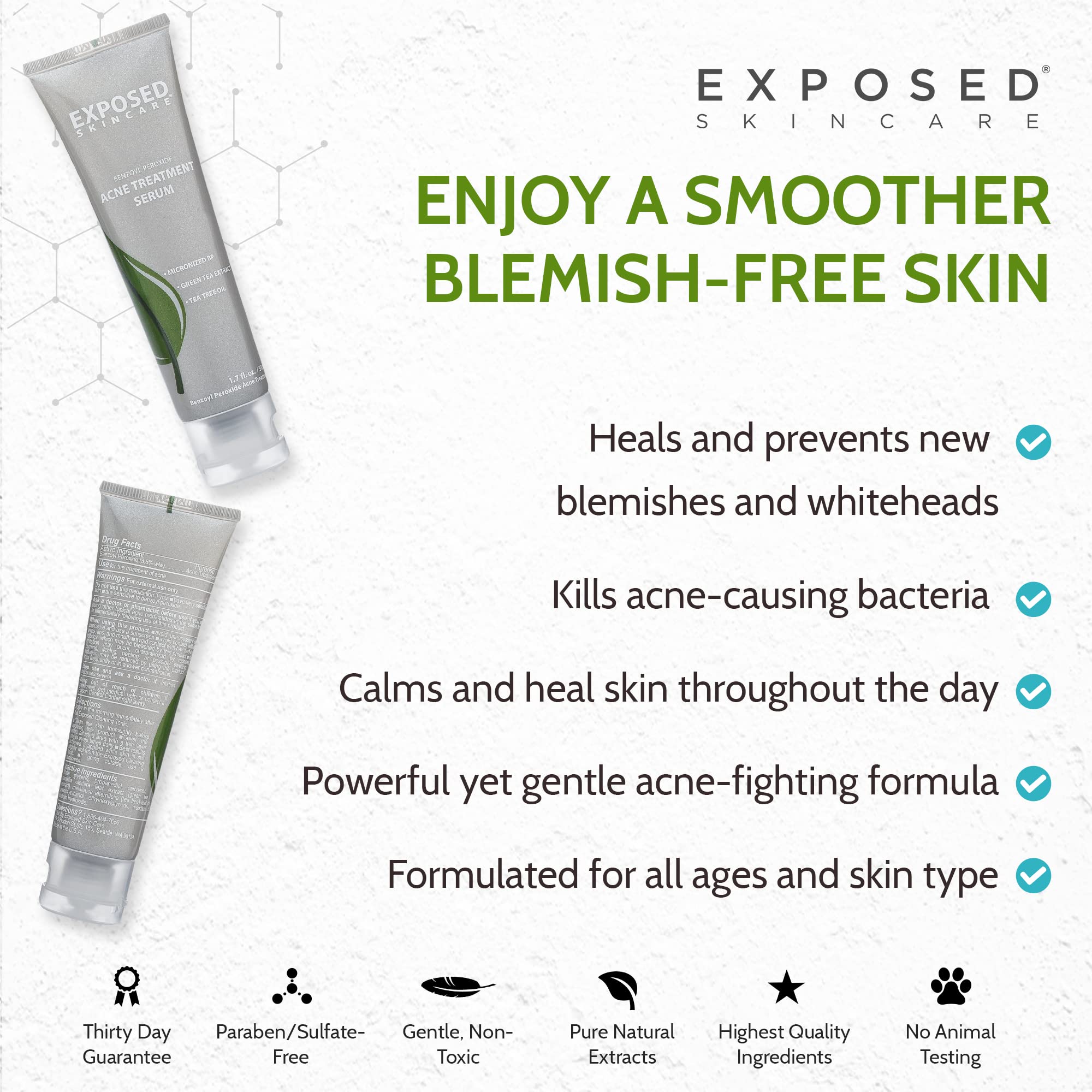 Exposed Skin Care Acne Treatment Serum Step 3 β Quickly Reduces Pimple Size and Redness - 12 Hour Spot Treatment - 3.5% Benzoyl Peroxide, Natural Green Tea & Tea Tree Oil