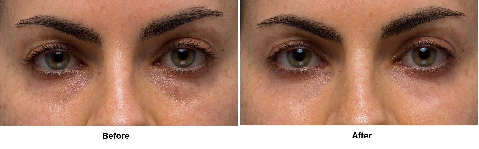 Dr. Dennis Gross Hyaluronic Marine™ Dew It Right™ Eye Gel: for Puffiness, Dark Circles, Dry, and Dehydrated Fine Lines, 0.5 fl oz