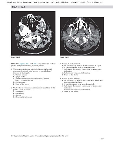 Head and Neck Imaging: Case Review Series