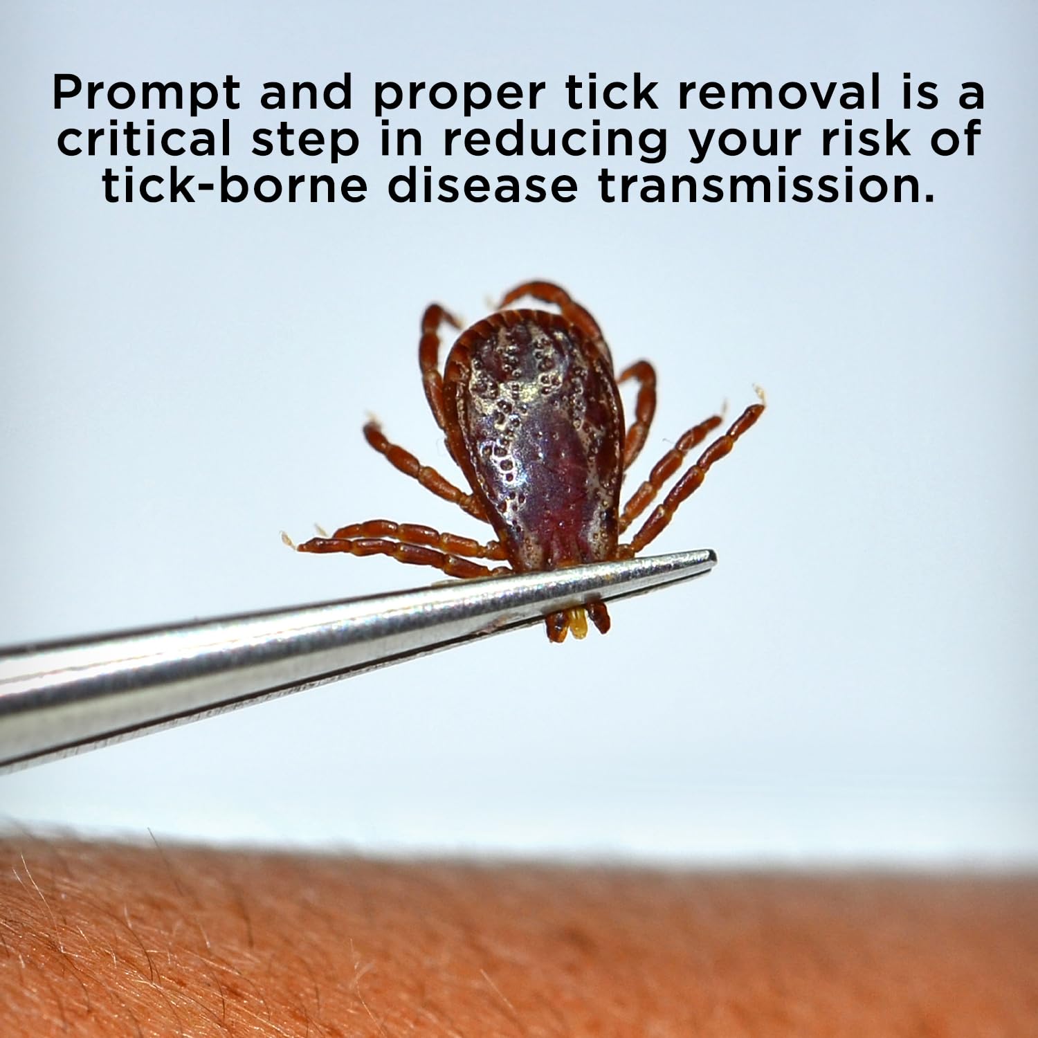 BUG BITE THING Tick Remover Tool for People & Pets, Patented Two Sided Stainless Steel Design with Fine Tipped Tweezers, Formerly Known as TickEase
