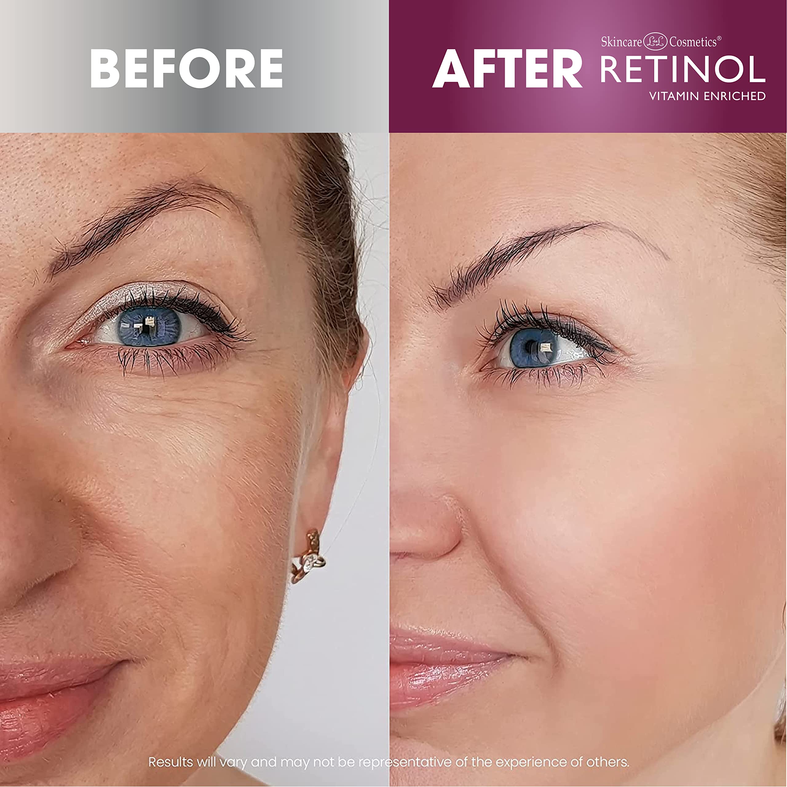 Retinol Anti-Aging Gel Cleanser โ Gently Cleans Impurities From Pores & Exfoliates for Soft, Smooth Skin โ Antioxidant-Rich Micro-Beads w/ Vitamin A & E Maximize Renewing Benefits Of Retinol