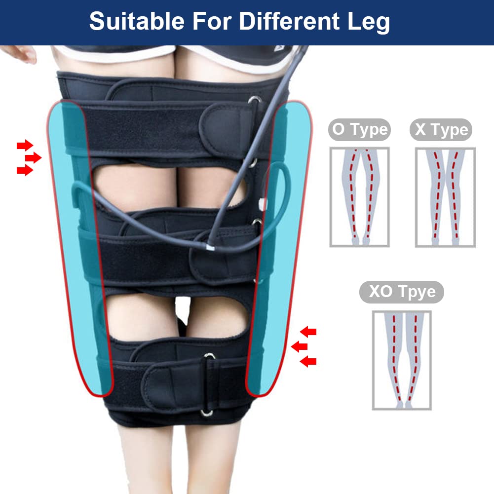 AKACIJA O/X Legs Correction Belt Legs Posture Corrector Bow Legs Band Bandage Straighten Belt for Men Women