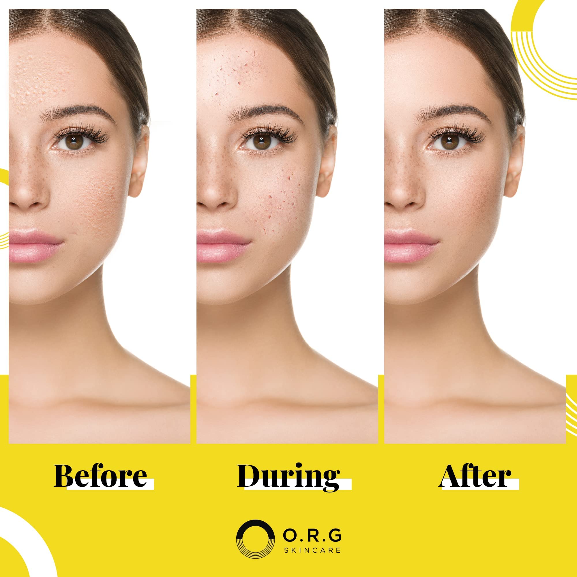 ORG Peel Off Face Cleanser for Gentle Exfoliation and Glowing Skin - Korean Sensitive Skincare - Pore Minimizer Brightening Agent Cruelty Free Natural Formula 2oz