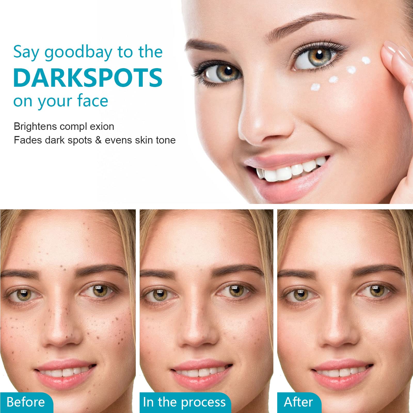 AIOBEECY Dark Spot Corrector Cream - Evens Skin Tone, Reduces Pigmentation & Sunspots, for Face & Body (5.65 oz)