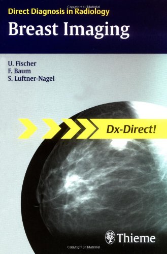 Breast Imaging (Direct Diagnosis in Radiology)