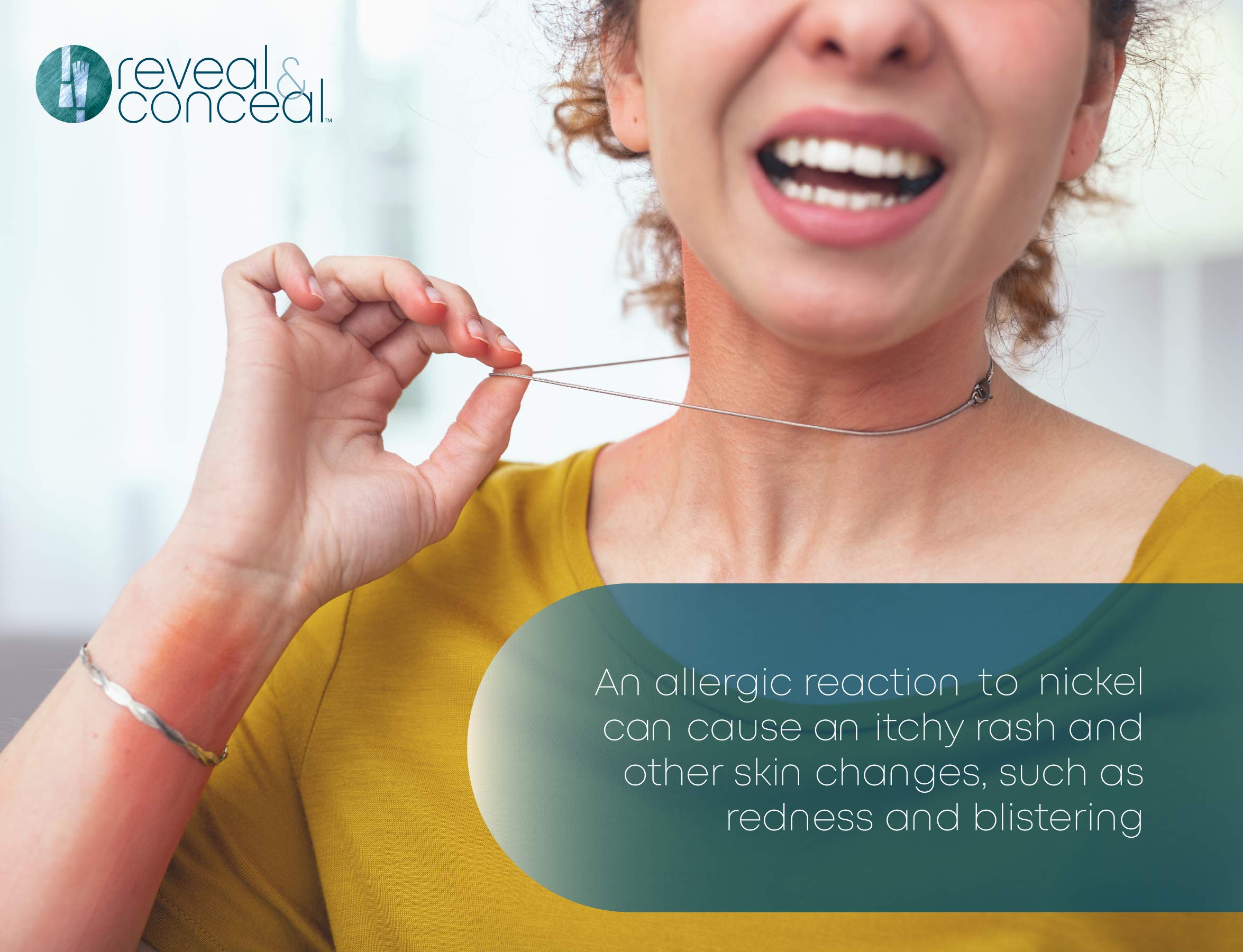 Reveal and Conceal Nickel Allergy Test Kit by Smart Practice - Detecting Nickel is a Snap - Test for Nickel in Your Jewelry and Prevent Skin Exposure With Liquid Clear Coat - Includes 10 Test Swabs