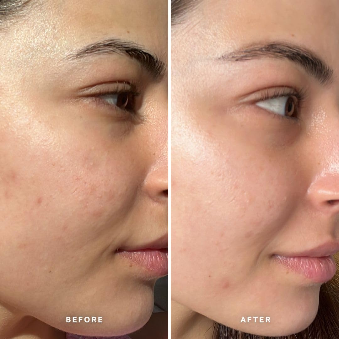 LIQUID GOLD EXFOLIATING TREATMENT WITH 5% GLYCOLIC ACID