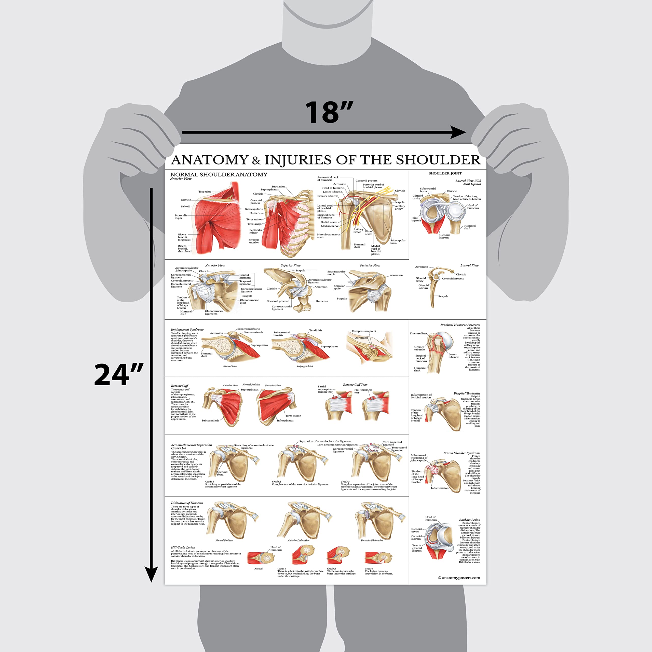 Palace Learning 2 Pack - Anatomy and Injuries of The Shoulder & Hip Poster Set - Anatomical Chart Set - Laminated 18" x 24"