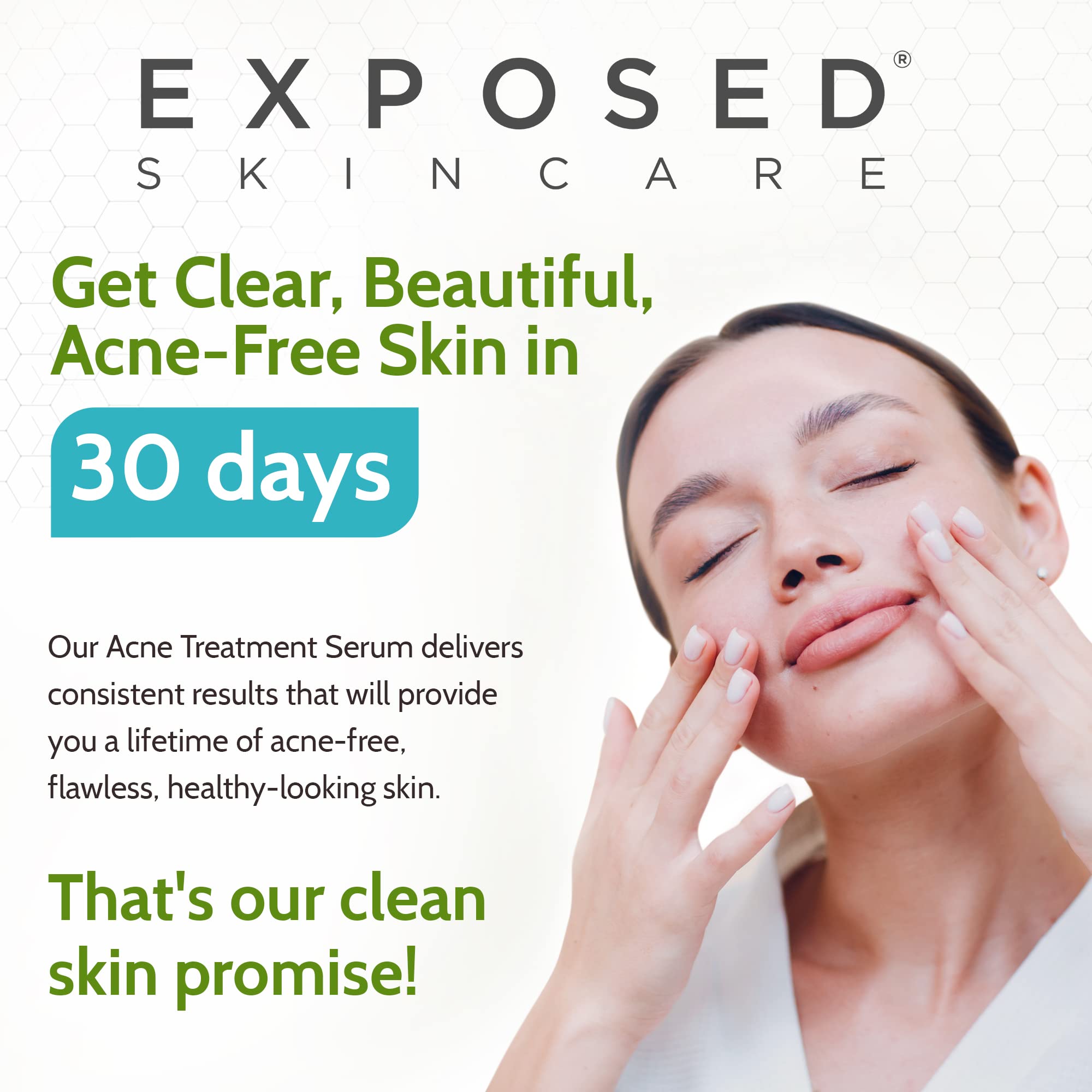 Exposed Skin Care Acne Treatment Serum Step 3 β Quickly Reduces Pimple Size and Redness - 12 Hour Spot Treatment - 3.5% Benzoyl Peroxide, Natural Green Tea & Tea Tree Oil