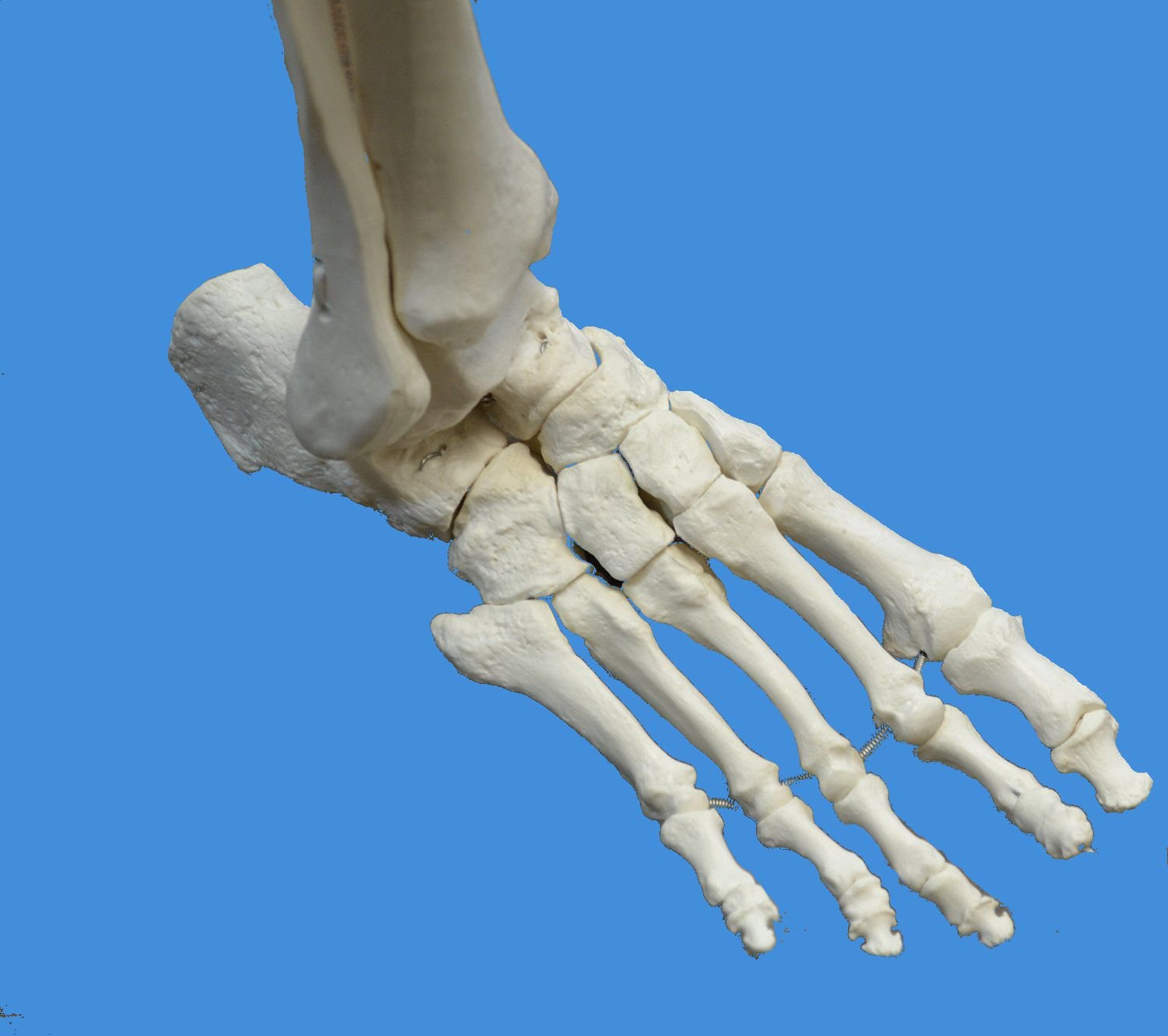 Wellden Medical Anatomical Human Lower Limb Skeleton Model, Life Size