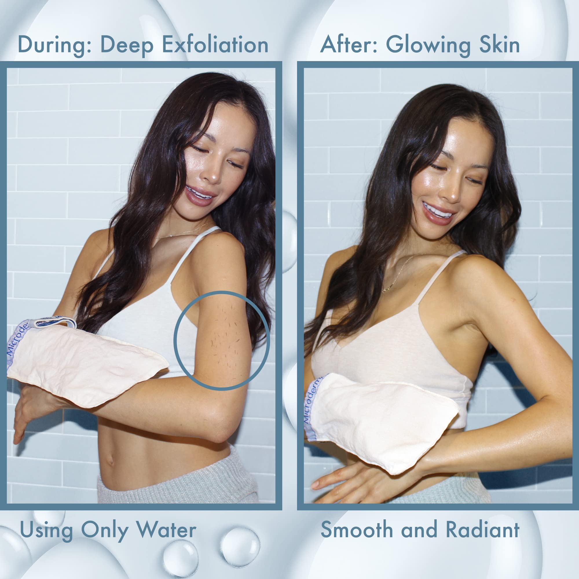 MicrodermaMitt Deep Exfoliating Mitt for Shower β Dead & Dry Skin Remover - Keratosis Pilaris β Body Exfoliator Glove for Men & Women - No Dyes