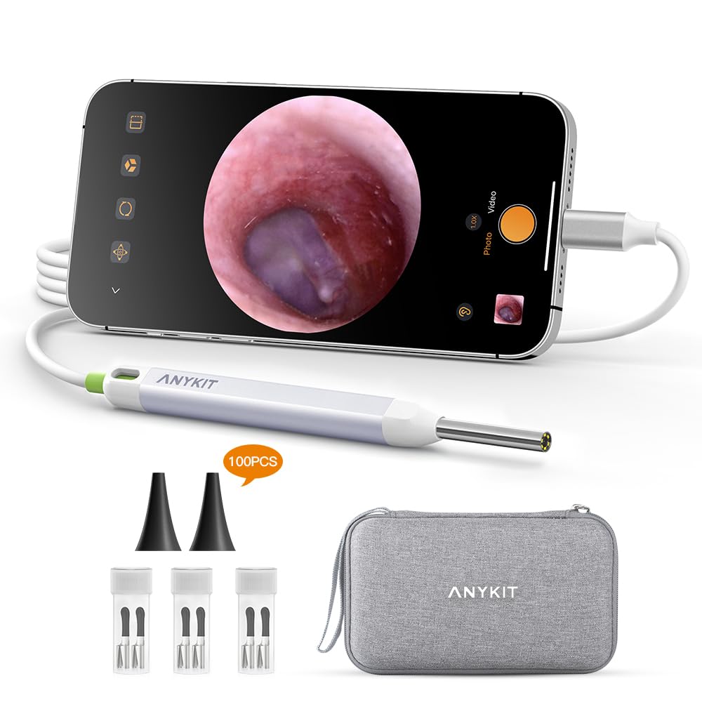 Anykit Digital Otoscope with Gyroscope, HD Ultra Clear View Ear Camera with Ear Wax Removal Tools, Video Ear Scope Otoscope with Light, Compatible with Android, iPhone 15 (White)