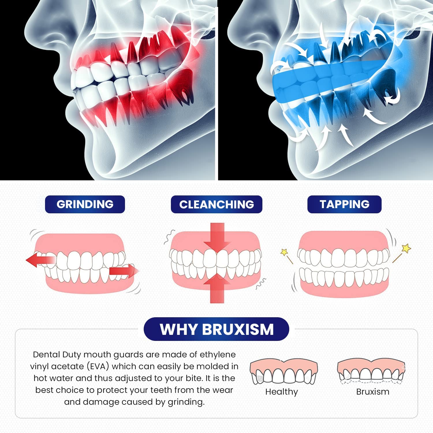 Professional Mouth Guard for Grinding Teeth - 2 Sizes 4 Pieces Mouthguard, Moldable Night Guards for Teeth Grinding, Night Guard for Bruxism & Teeth Clenching - Dental Guard Case