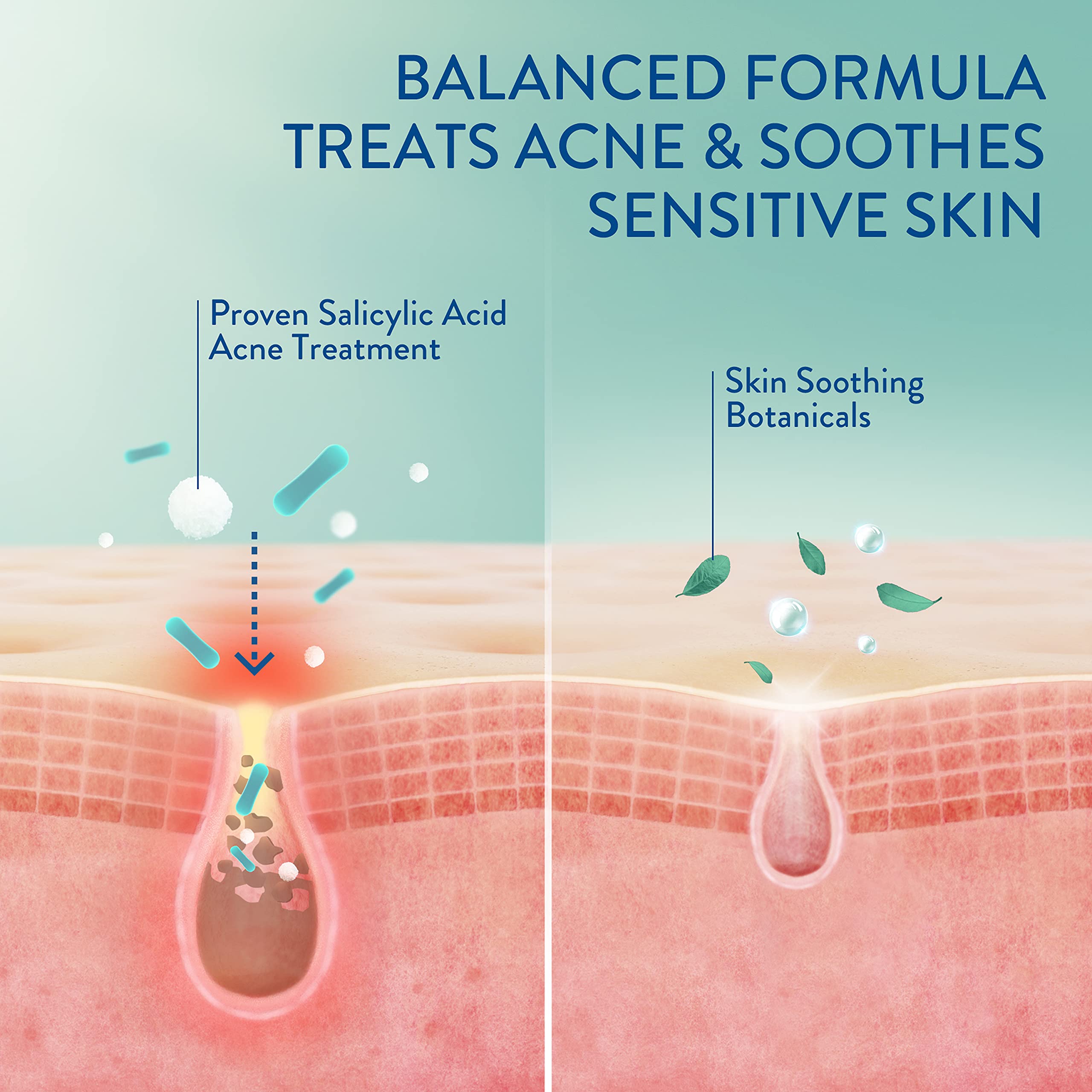 Cetaphil Acne Clearing Kit - Clarifying Acne Cream Cleanser (4.2 oz) & Mattifying Acne Moisturizer (3 oz) with Salicylic Acid, Deep Clean, Hydrate and Treat Sensitive Acne Prone Skin