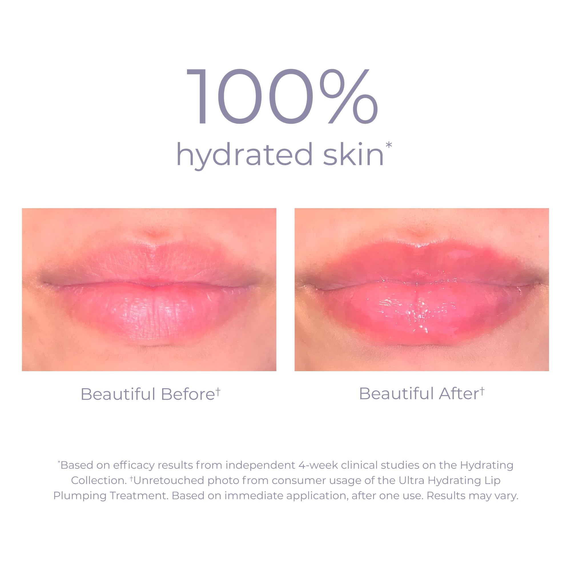 DERMA E Ultra Hydrating Lip Plumping Treatment β Advanced Lip Plumper for Enhanced Fullness and Natural Color β Lip Moisturizer with Hyaluronic Acid, Cinnamon and Jojoba Oil, 0.34 Fl Oz