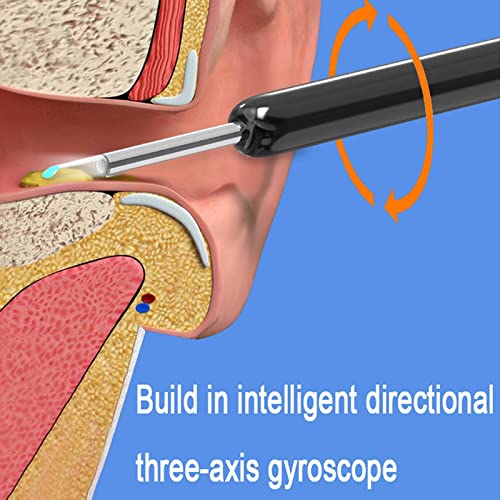 BBASILIYSD 2022 Camera Ears Cleaning Wi -fi Visible Wax Elimination Spoon USB 1080p Hd Visible Wax Wi Spoon Otoscope Elimination Load Fi