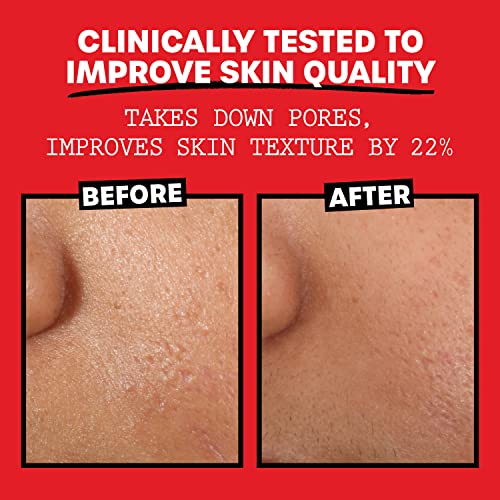 Thayers Alcohol-Free Rose Petal Witch Hazel Facial Toner for Glowing Skin, Soothing, Hydrating, Refreshing Toner for Normal and Combination Skin, 3oz