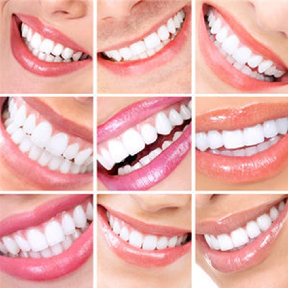 Dentistry Hygiene Oral Care Fresh Breath Teeth Tooth Tongue Cleaning Cleaner Toothbrush Scraper Flosser Whitening Kits