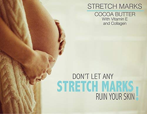 Lawrens Strech Marks Cocoa Butter with Vitamin E and Collagen - Minimizes Apperence of Stretch Marks - Moisturizes skin - 16 oz