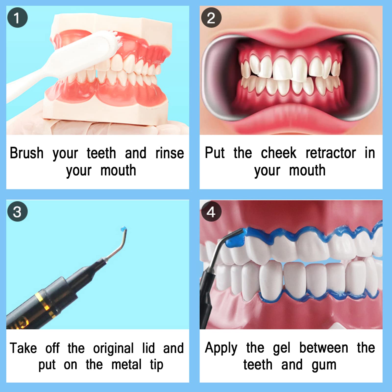Dental Gingival Barrier Protection Gel, 10PCS 3ML Gum Protector Gel for Teeth Whitening