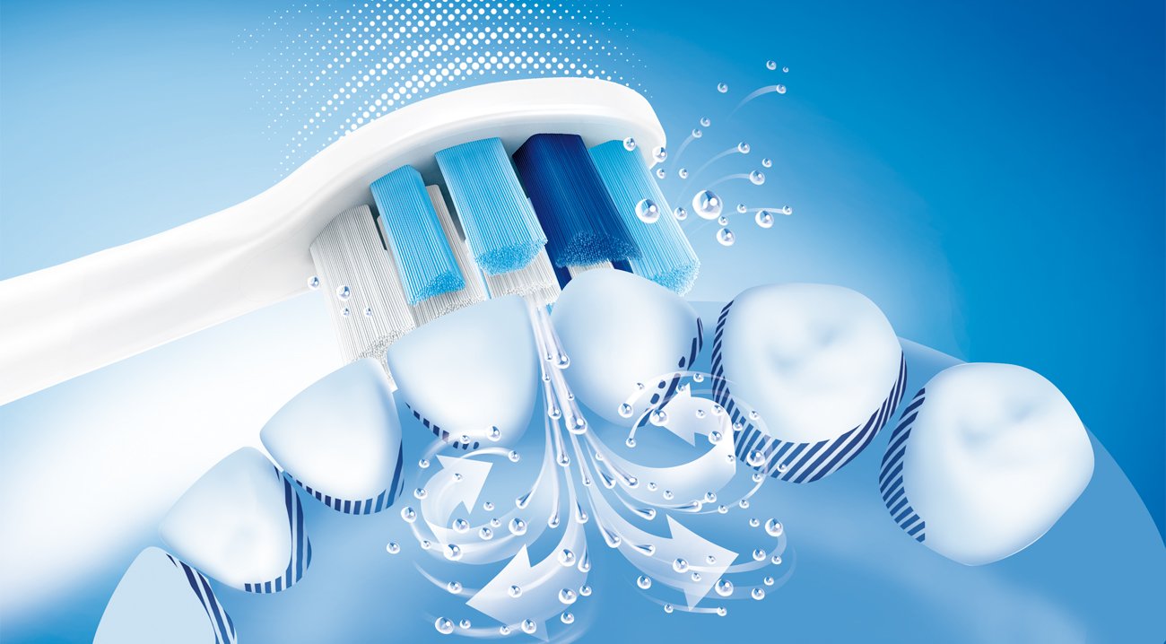 Philips Sonicare 3 Series Gum Health Sonic Electric Toothbrush, Hx6631/24, 1 Pound