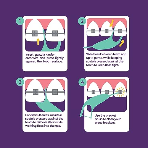 Platypus Orthodontic Flossers for Braces, 30 Count (Pack of 3), Ortho Picks for Adults & Kids, Fits Under Arch Wire, Non-Damaging, Encourage Flossing Habits