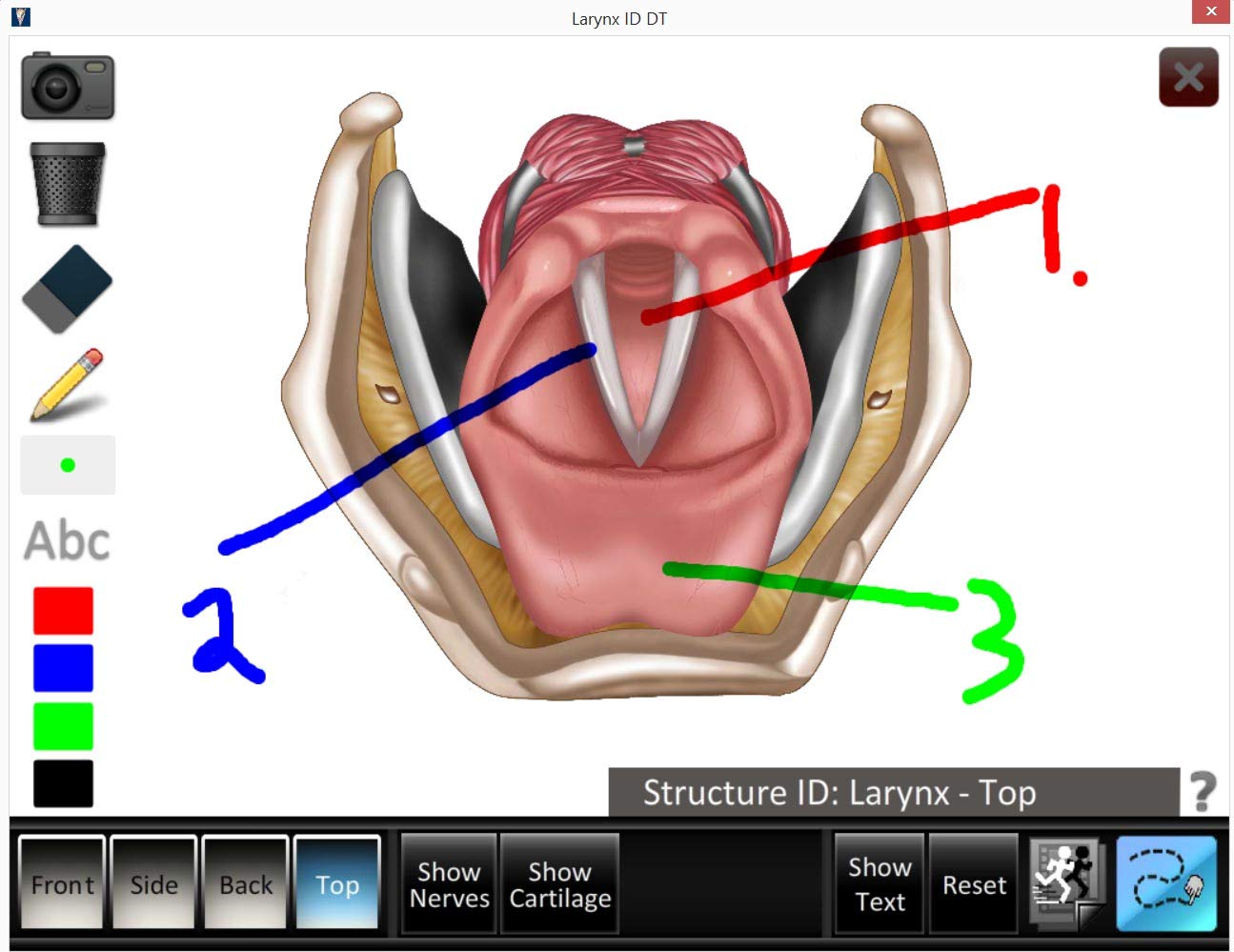 Vocal Parts, Pharynx & Larynx Anatomical Chart with Software Larynx and Vocal Fold ID Speech Language Pathology, SLP, Singing
