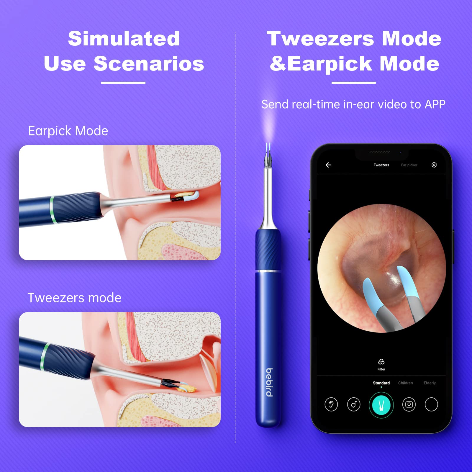 Bebird Note5 Pro,Flagship Models,10 Megapixel HD,3-in-1,Ear Wax Removal Tool Camera,Tweezers and Rod,25 Pcs,Ear Cleaner with Camera,Bebird Ear Cleaner,Ear Wax Removal,Otoscope [Starry Blue]