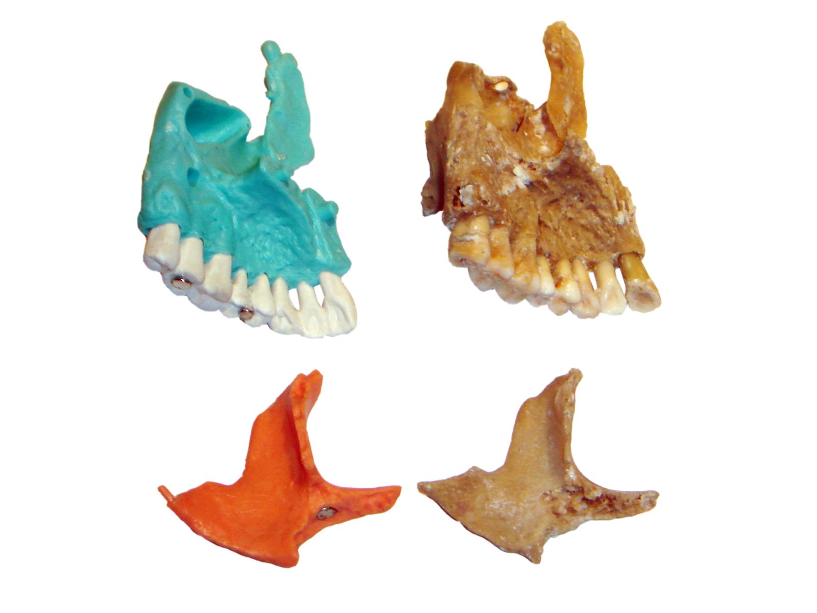 Human Medical Anatomical Adult Osteopathic Skull Model, 22-Part Didactic Colored