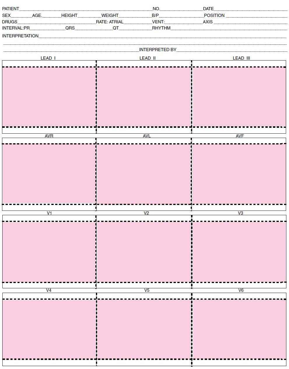 ECG Mount for 12-lead Tracing, 8 1/2" X 11" Portrait Mount Sheet, Peel & Stick, 100/pk