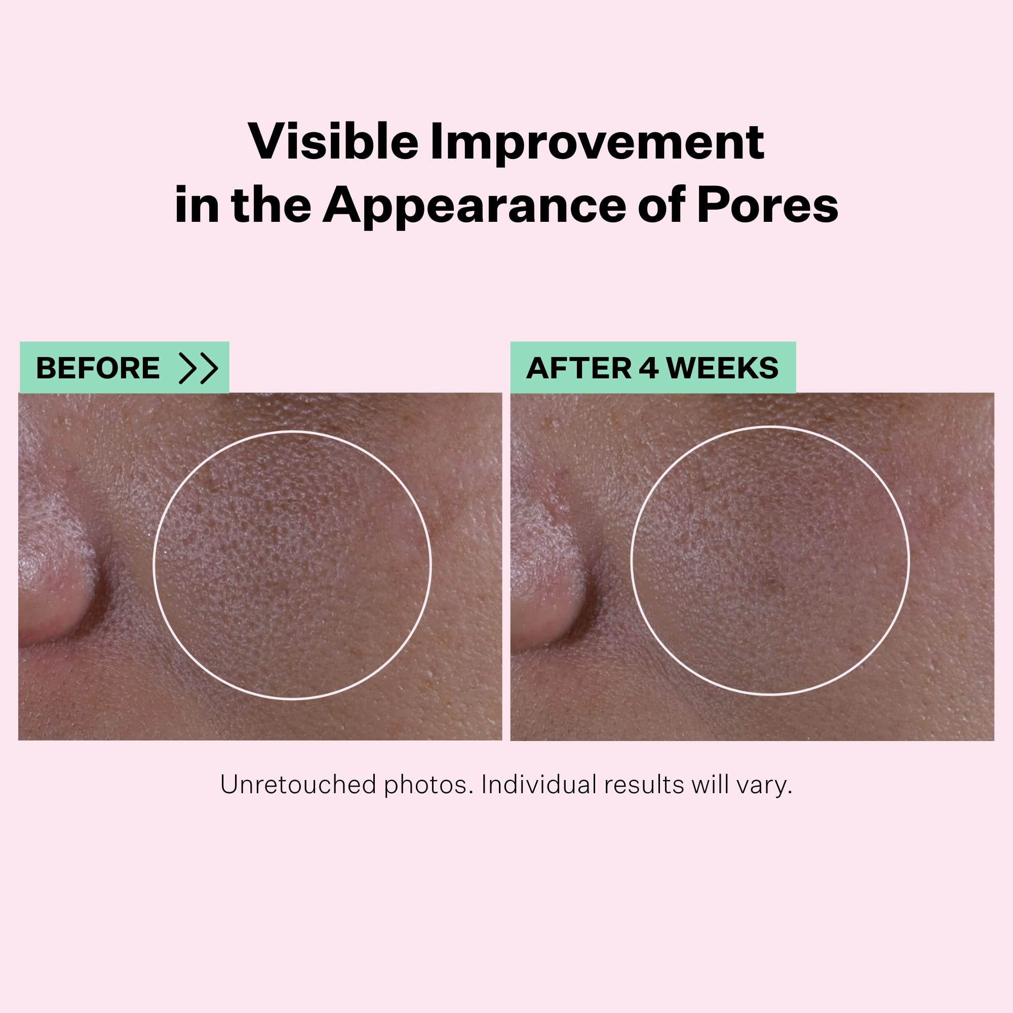 StriVectin Multi-Action Super Shrink Pore Minimizing Serum for minimizing clogged pores and blackheads for tightening and brightening skin texture