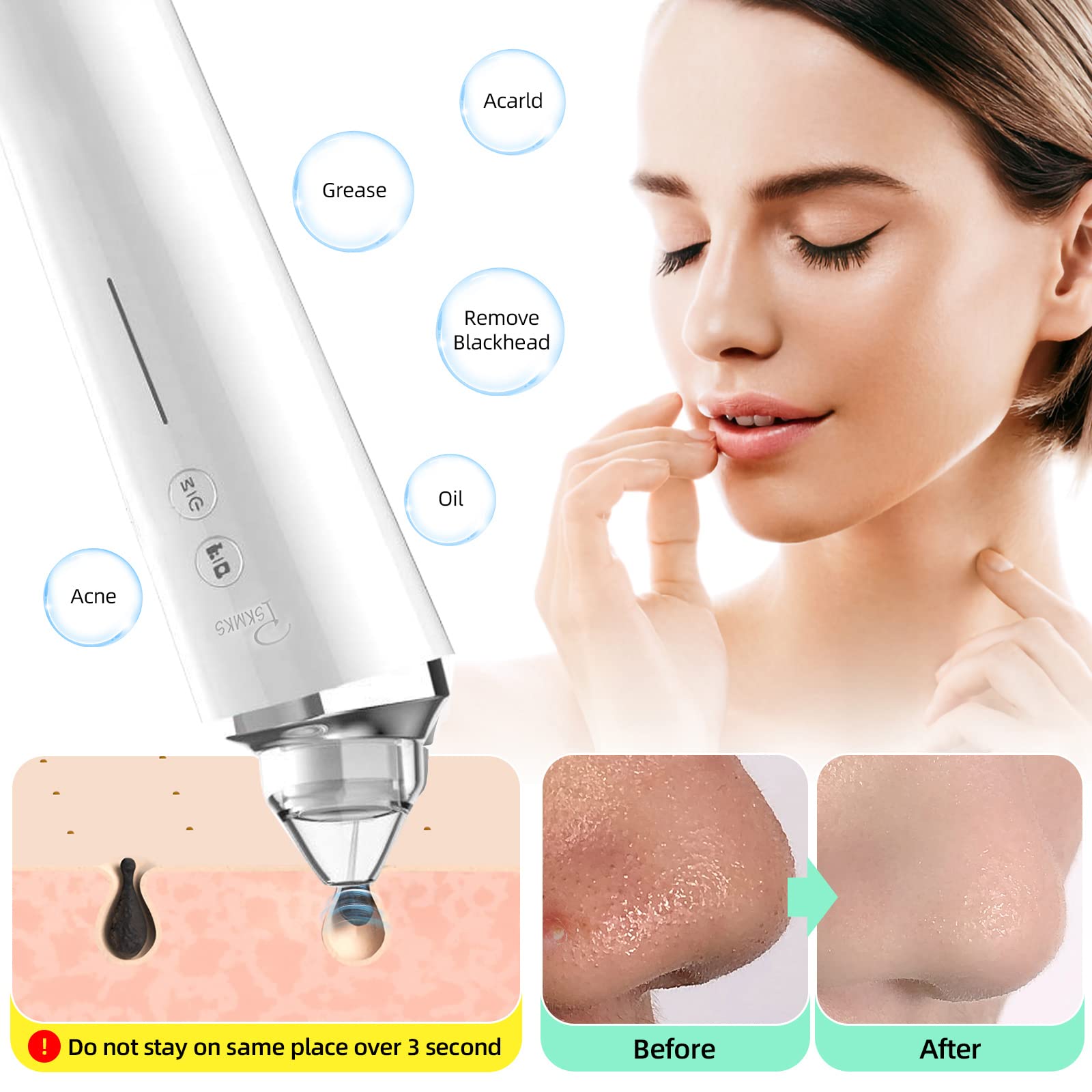 PSKMKS Blackhead Remover Vacuum with Camera 2021 Upgraded 5.0 MP Visual Facial Pore Cleaner USB Rechargeable Acne Comedone Whitehead Extractor Sucker Tool Blackhead Remover Kit Suction for Women & Men
