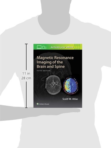 Magnetic Resonance Imaging of the Brain and Spine