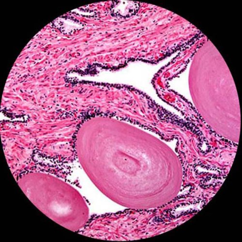 AmScope M150C-E-I 40X-1000X LED Cordless All-Metal Framework Full-Glass Optical Lens Student Biological Compound Microscope + Digital Camera USB Imager