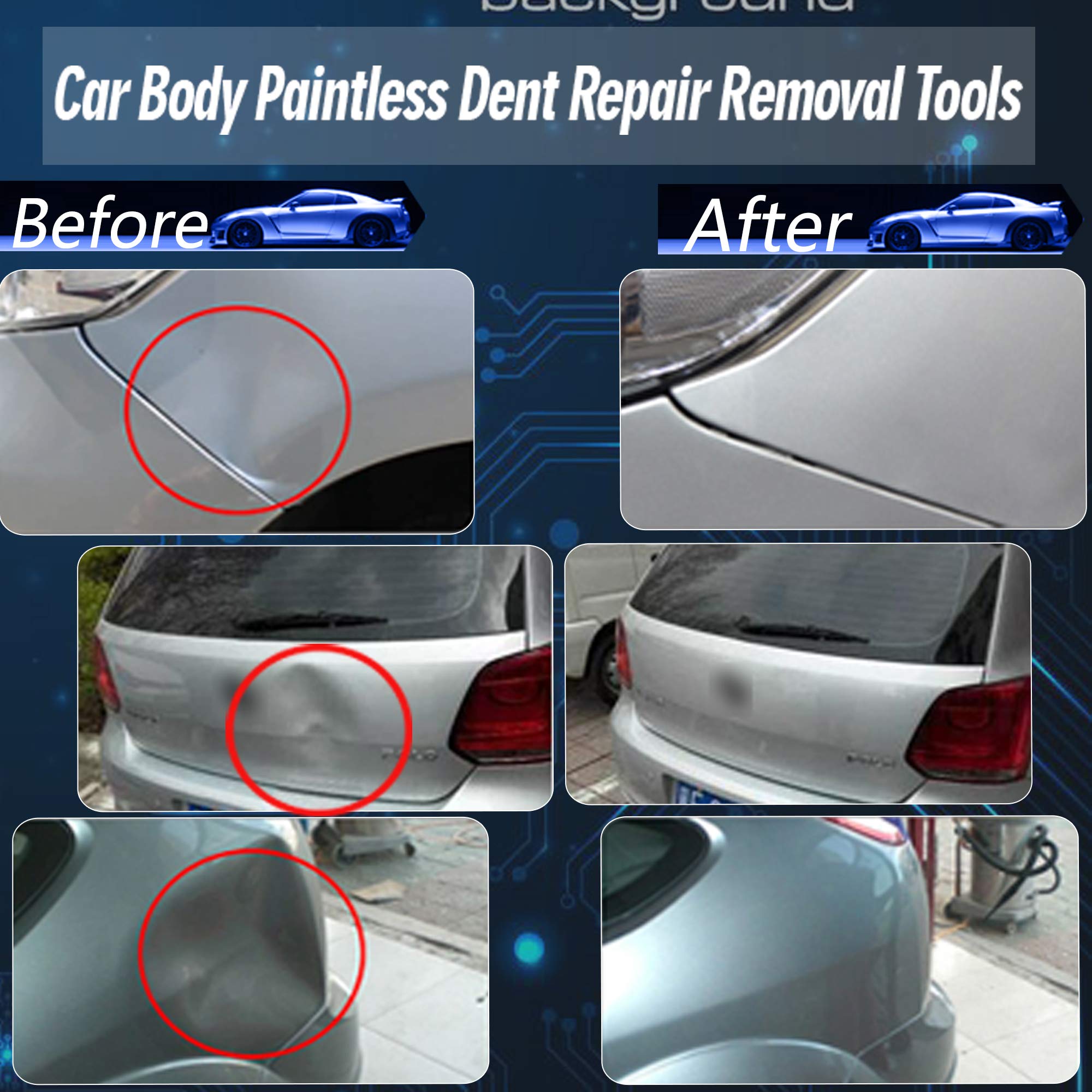 Anyyion 98pcs Paintless Dent Repair Kits,Car Body Dent Repair Tools Hail dent Removal Kit for Car Hail Damage Dent & Ding Remover(Full Set Starter Set Kits)