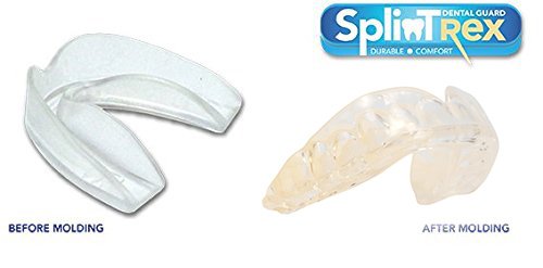 Professional Teeth Mouth Guards for Teeth Grinding and Clenching - Dental Protectors for Bruxism - 4 Pack - BPA Free - Multi Use - Free Storage Case