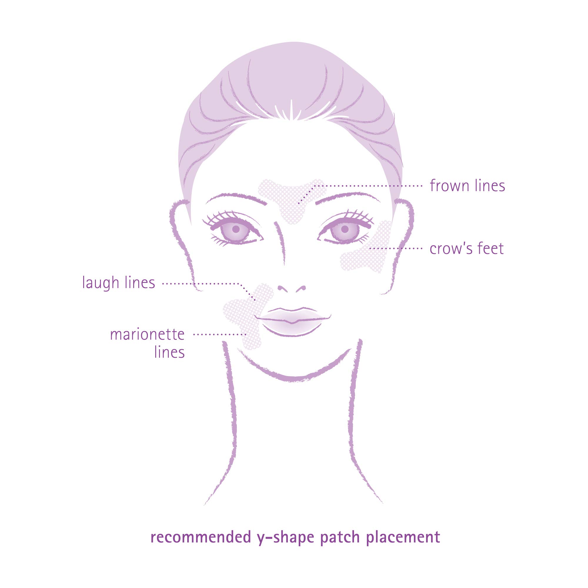 Toute Nuit Facial Wrinkle Patches, Face Tape, Y-Shape, Frown Lines, Around Eyes and Mouth, 20 Patches