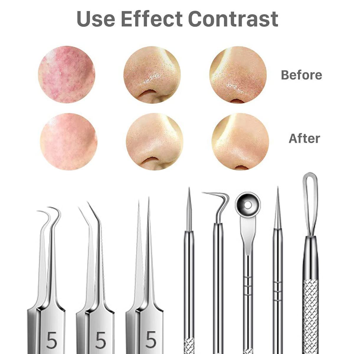 Blackhead Remover Tools - Pack of 8Pcs Silver Pimple Popper Tool Kit, Black Head Extractions Tool, Stainless Steel Acne Blackhead Tools with Portable Metal Case