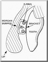 Morgan Bumper Braces Cover Lip Protector Qty 2 - Clear