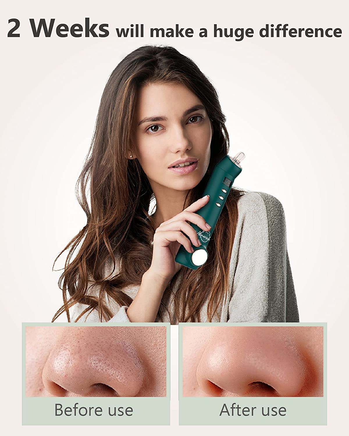 Blackhead Remover Pore Vacuum, Electric Facial Pore Extractor, 5 Suction Tips, Cold Heat Compress