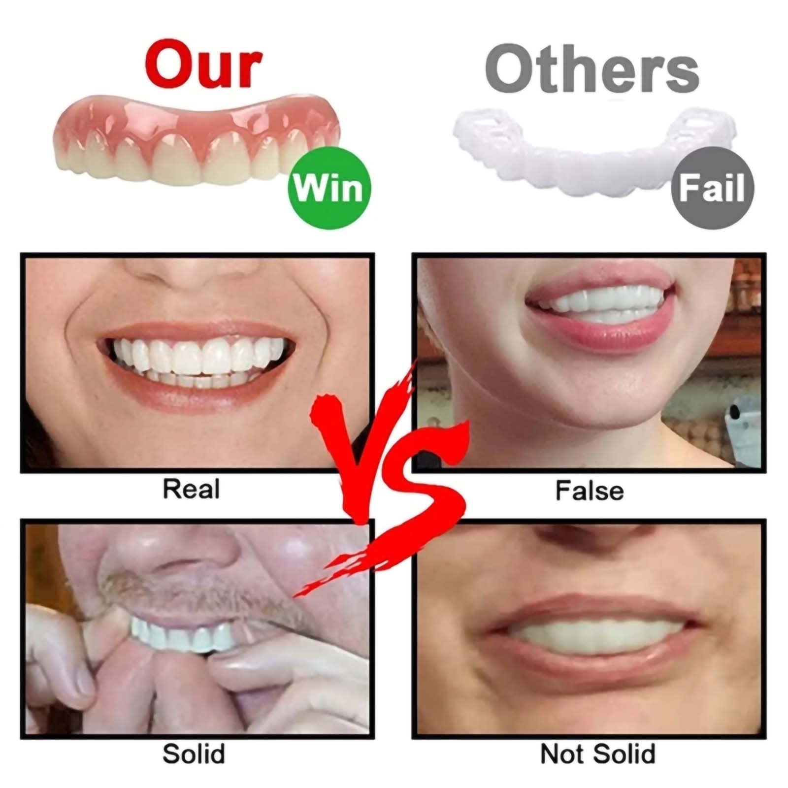 CHNLML Fake Teeth, Cosmetic Denture Veneers for Upper and Lower Jaw, Dental Veneers for Temporary Teeth Restoration, Nature and Comfortable, Protect Your Teeth - 2 Pcs